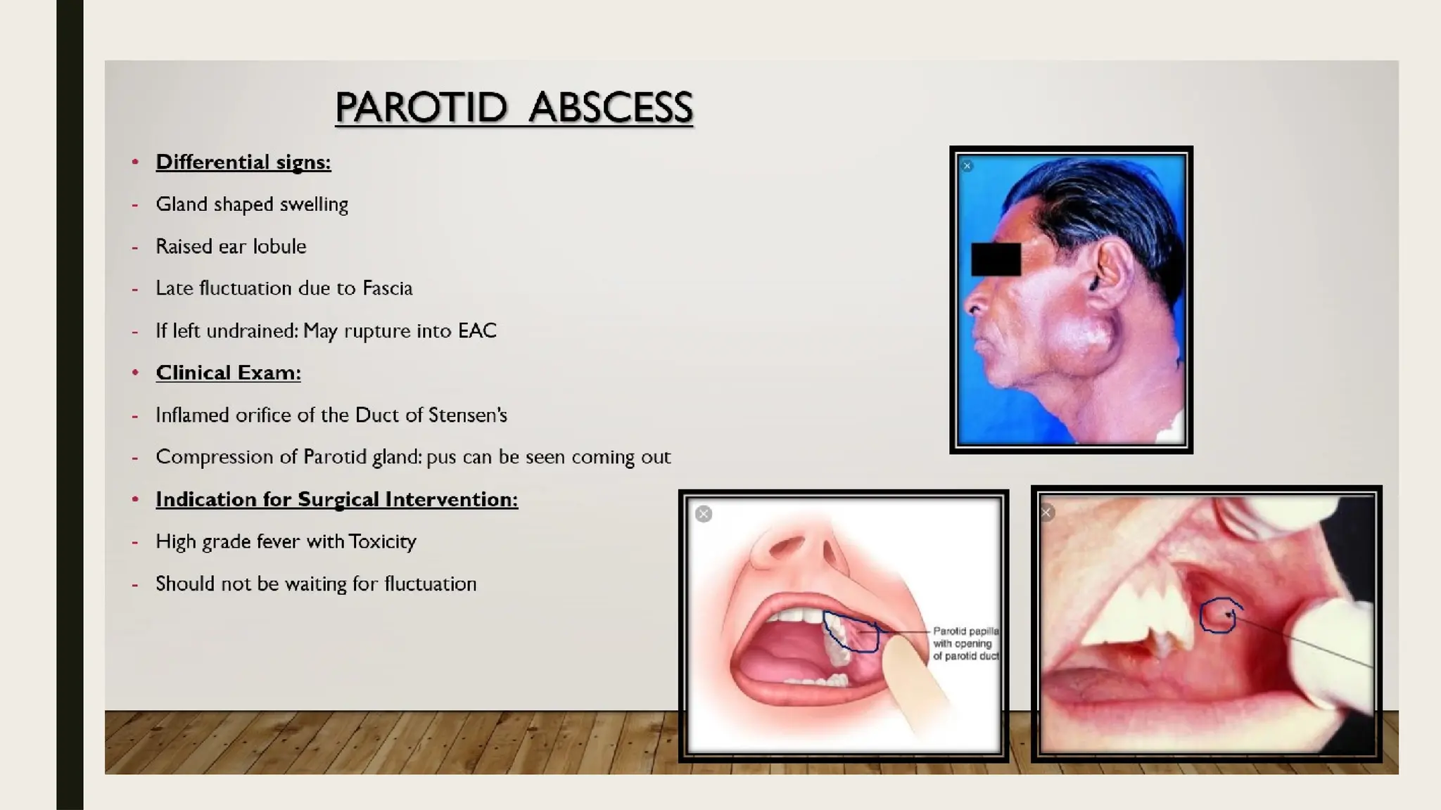 Manya-vikar- Galaganda, Gandamala, Apachi.pptx