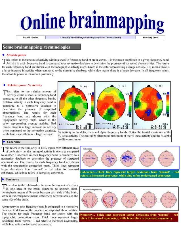 Issues in brain mapping...Polymorphic delta activity and its brainmap counterpart | PDF