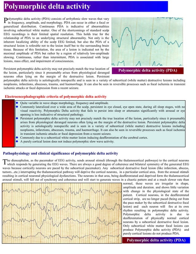 Issues in brain mapping...Polymorphic delta activity and its brainmap ...
