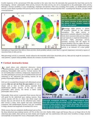 Issues in brain mapping...Polymorphic delta activity and its brainmap ...