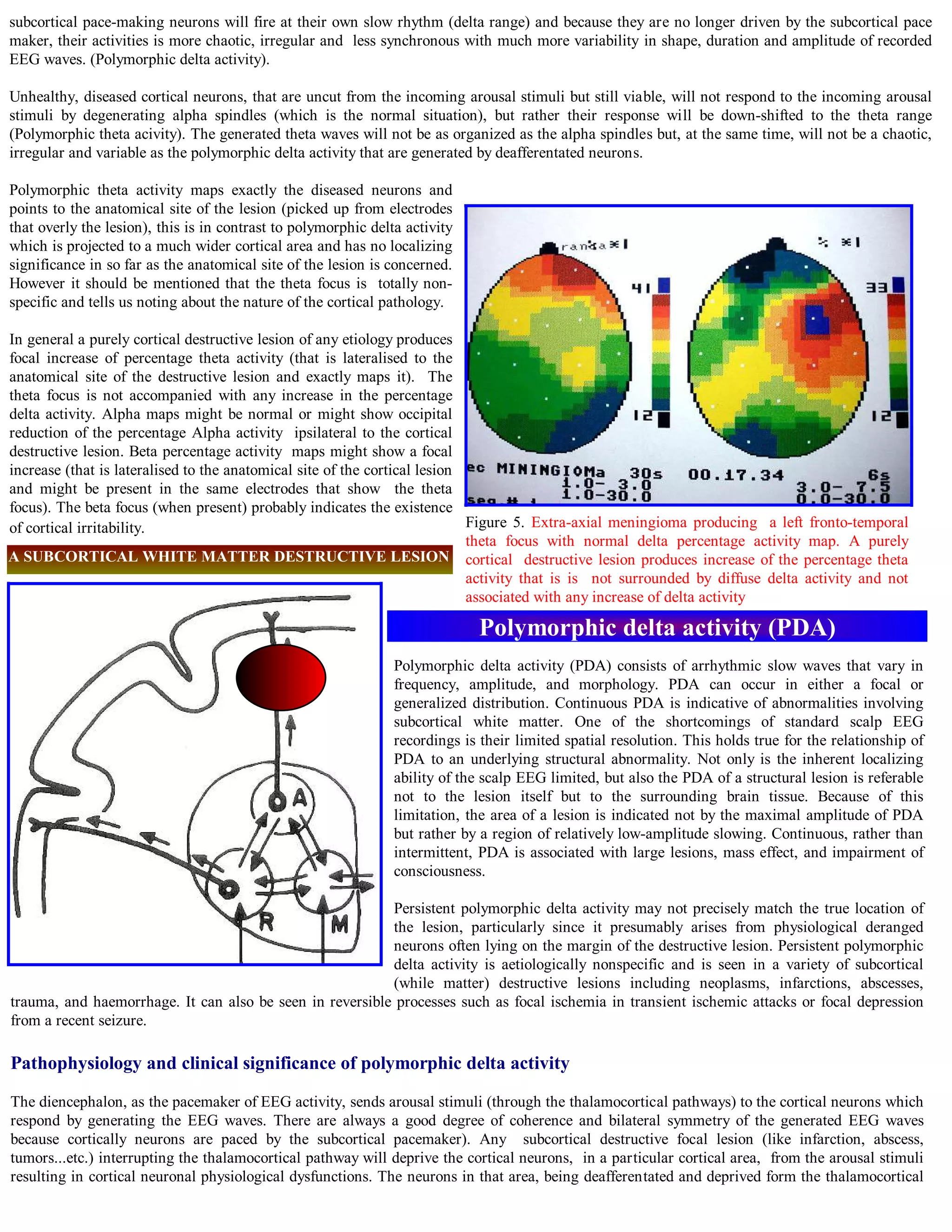 Issues in brainmapping...EEG and brainmap spectral profiles in cortical ...