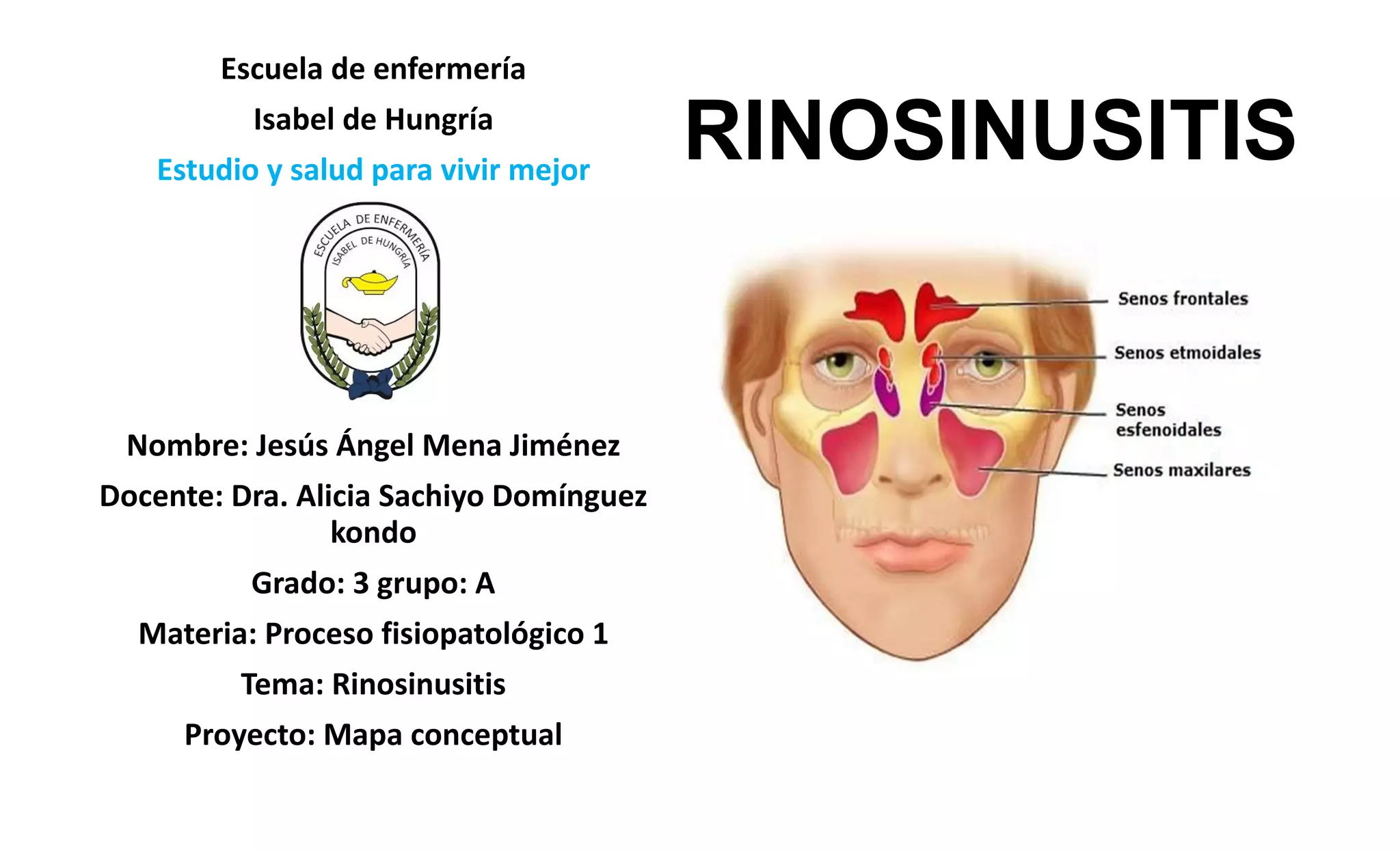 Mapa conceptual de rinosinusitis | PDF