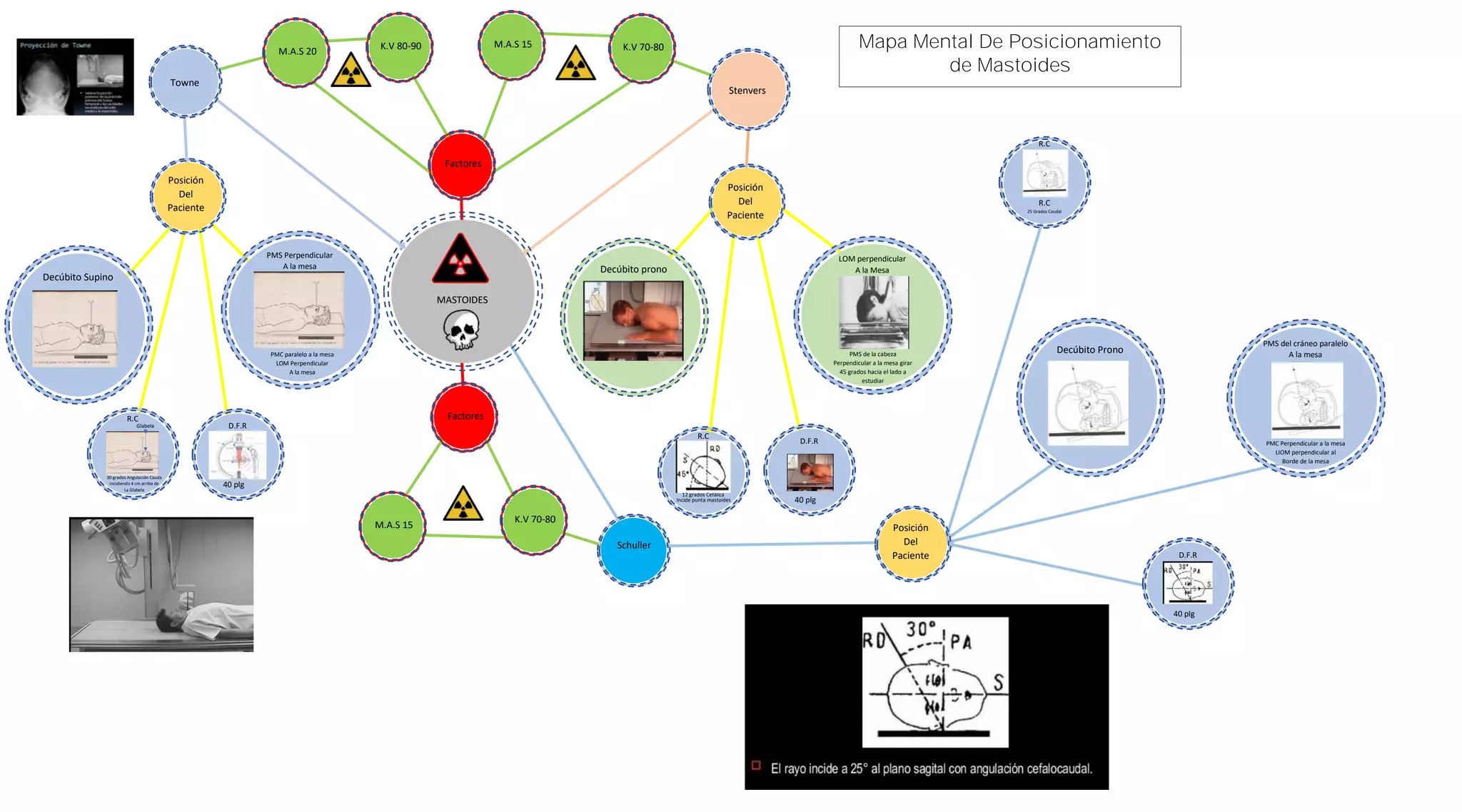 Mapa mental de Posicionamiento de Mastoides.pdf