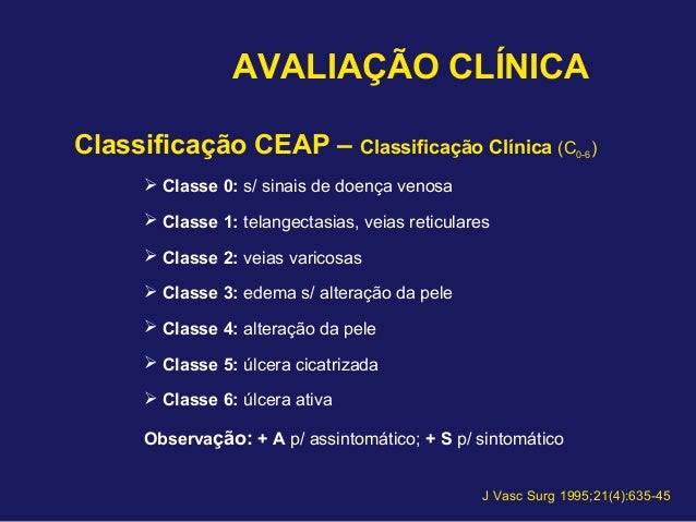 Mapeamento de varizes