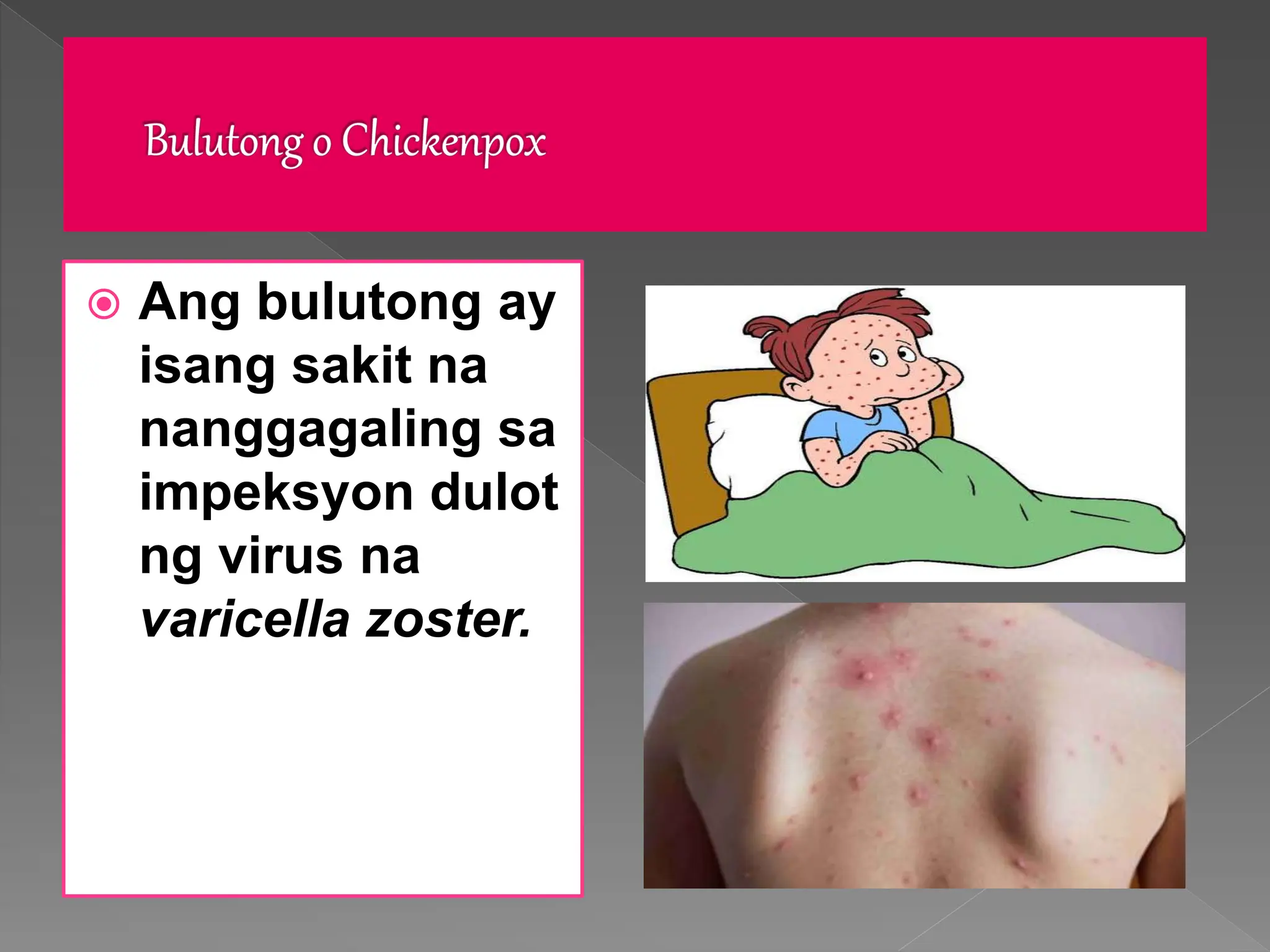 Mga Karaniwang Sakit ng Bata- MAPEH 3- Health | PPTX