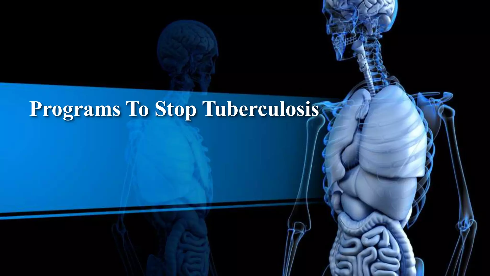 NATIONAL TUBERCULOSIS TB CONTROL PROGRAM | PPTX