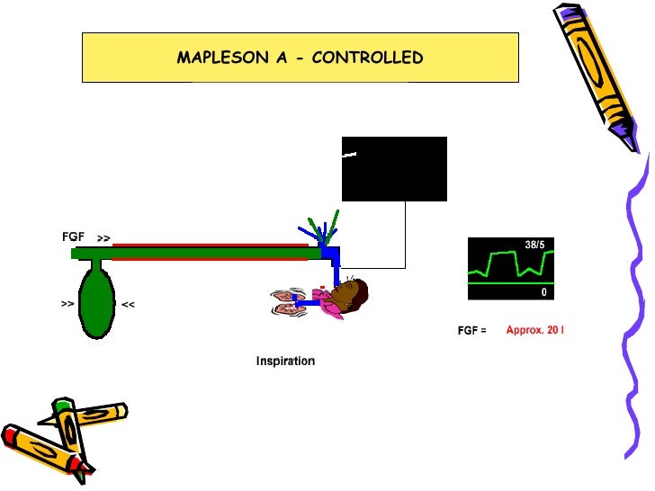 Mapleson breathing systems