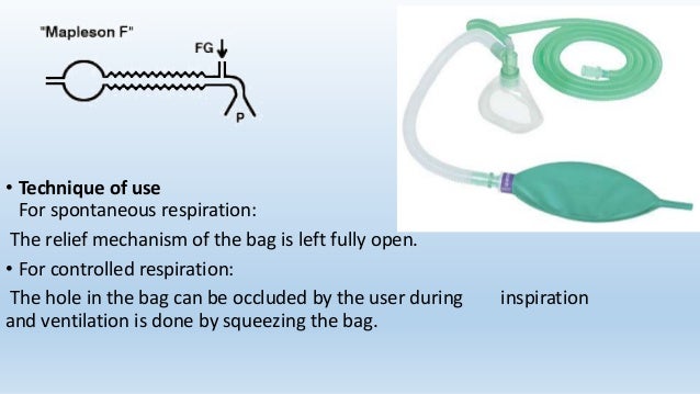 Mapleson breathing systems