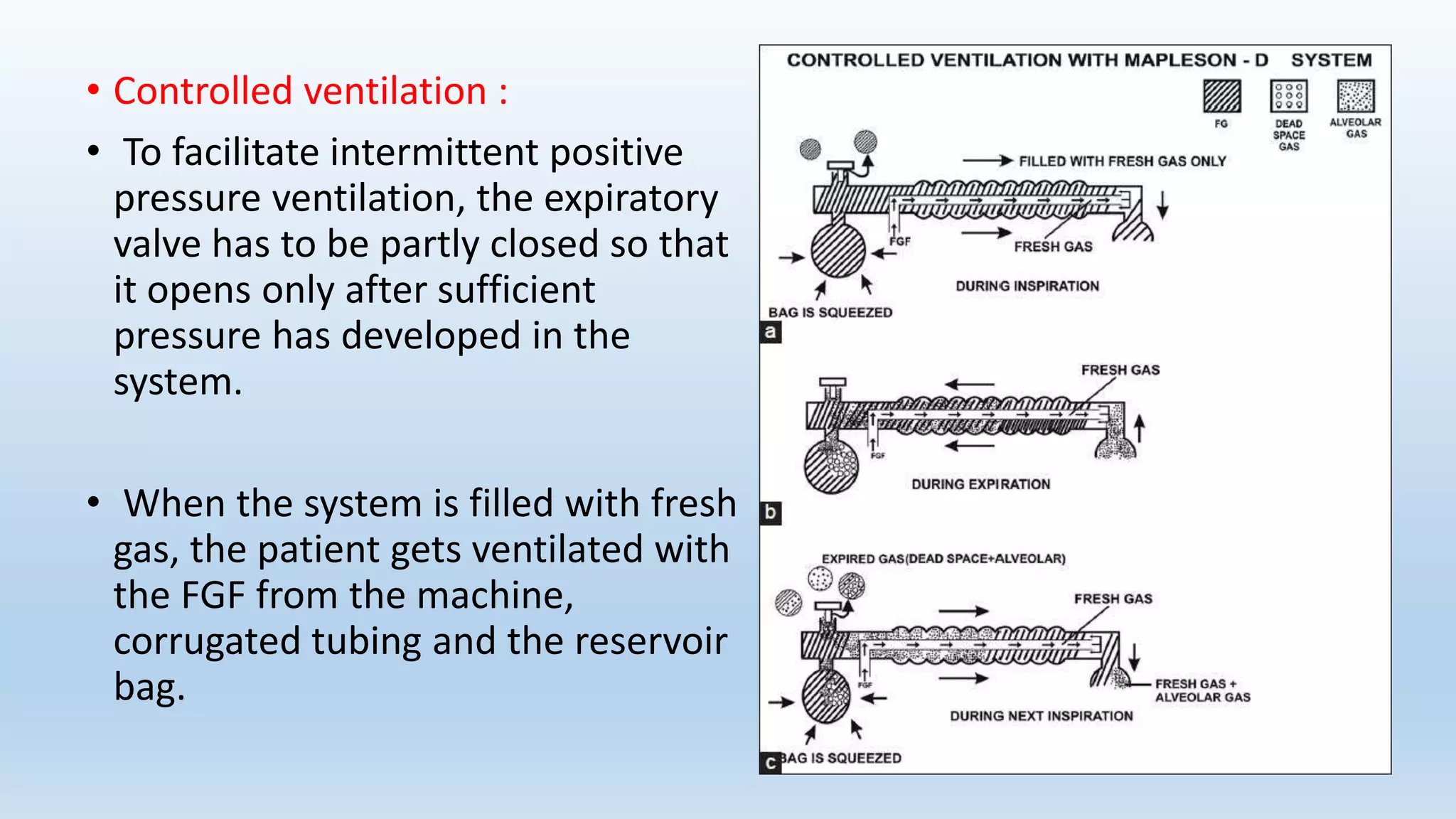 Mapleson breathing systems | PPTX