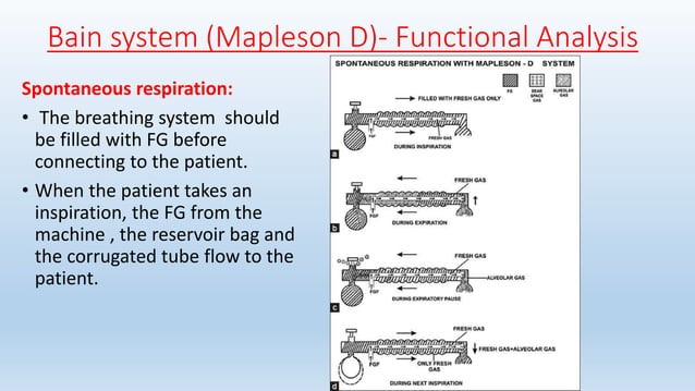 Mapleson breathing systems | PPTX
