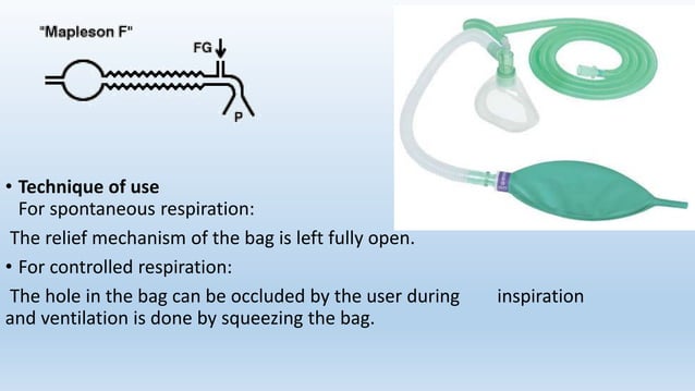 Mapleson breathing systems | PPTX