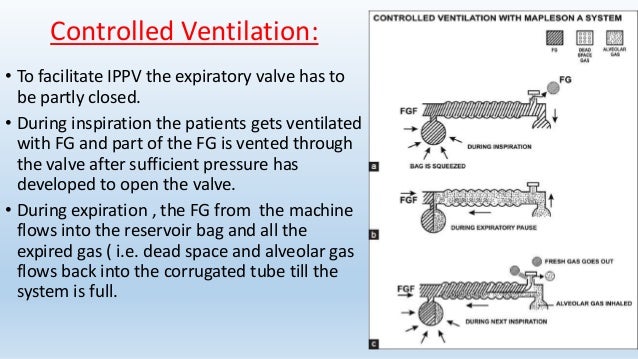 Mapleson breathing systems