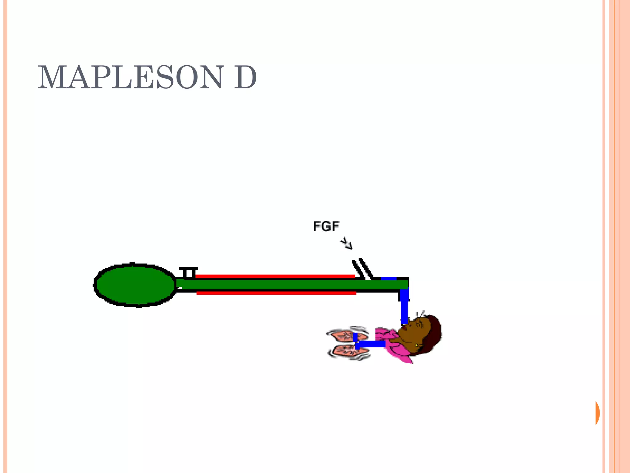 Mapleson circuits | PPT