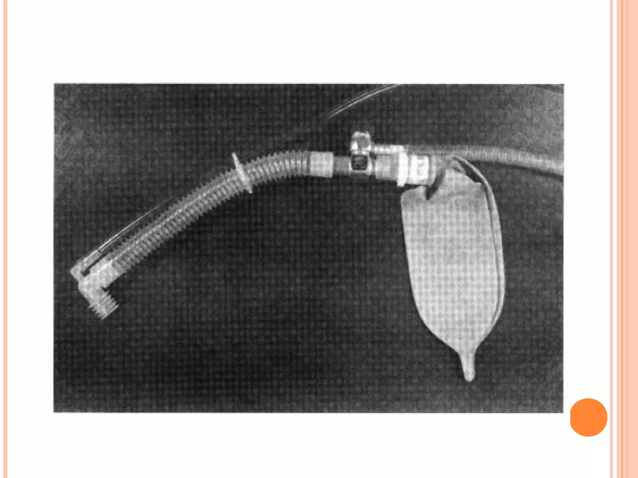 Mapleson circuits | PPT