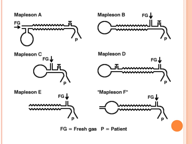 Mapleson circuits | PPT | Lung and Respiratory Health | Diseases and ...