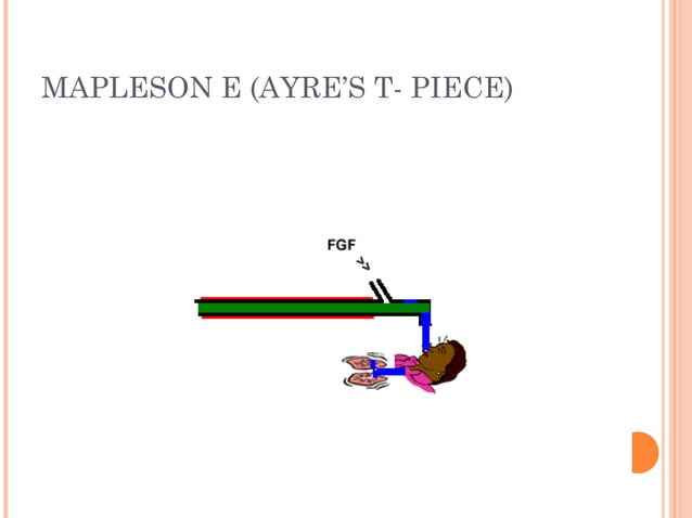 Mapleson circuits | PPT | Lung and Respiratory Health | Diseases and ...