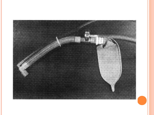 Mapleson circuits | PPT | Lung and Respiratory Health | Diseases and ...