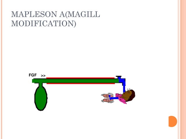 Mapleson circuits | PPT | Lung and Respiratory Health | Diseases and ...