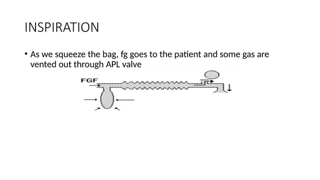 MAPLESON BREATHING CIRCUITS IN GENERAL ANAETHESIA | PPTX