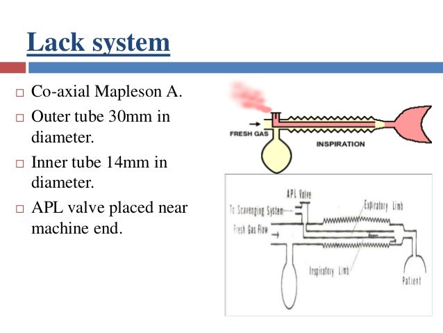 Mapleson system