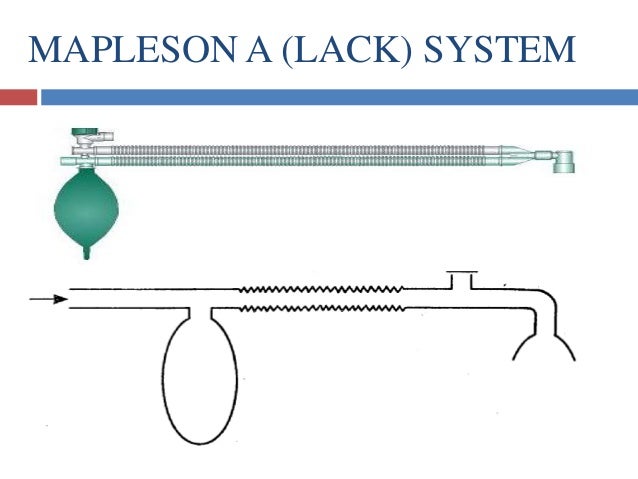 Mapleson system