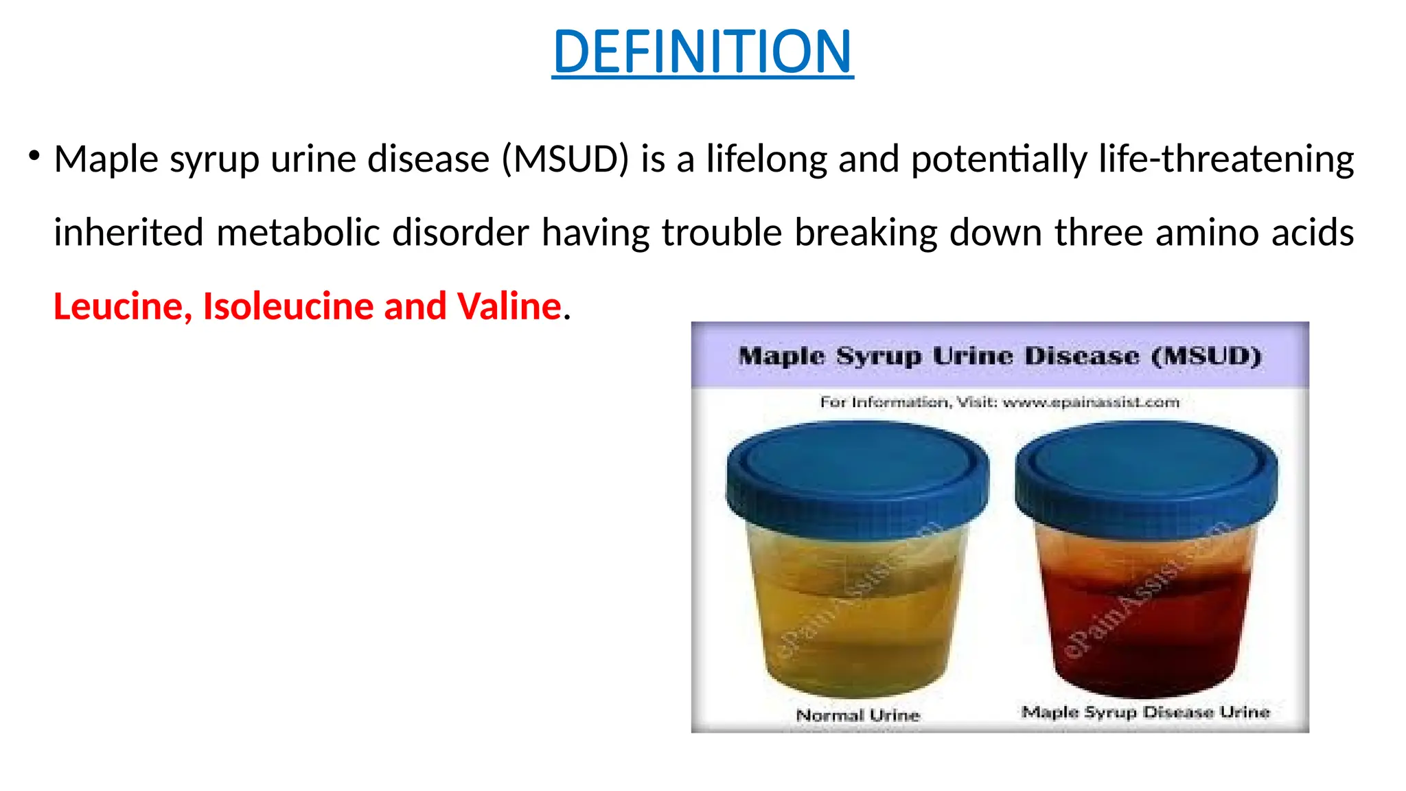 maple syrup urine disease in children.pptx
