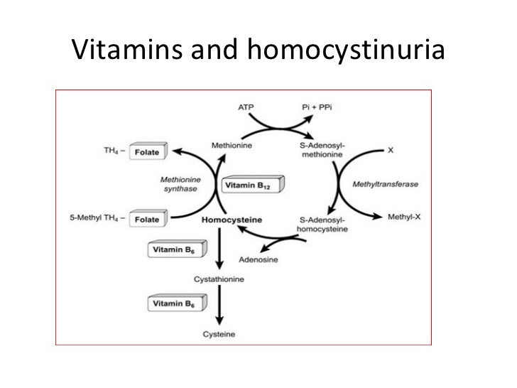 Maple syrup urine disease MSUD and Homocystinuria