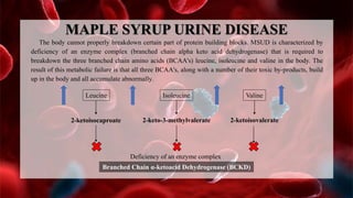 Maple Syrup Urine Disease