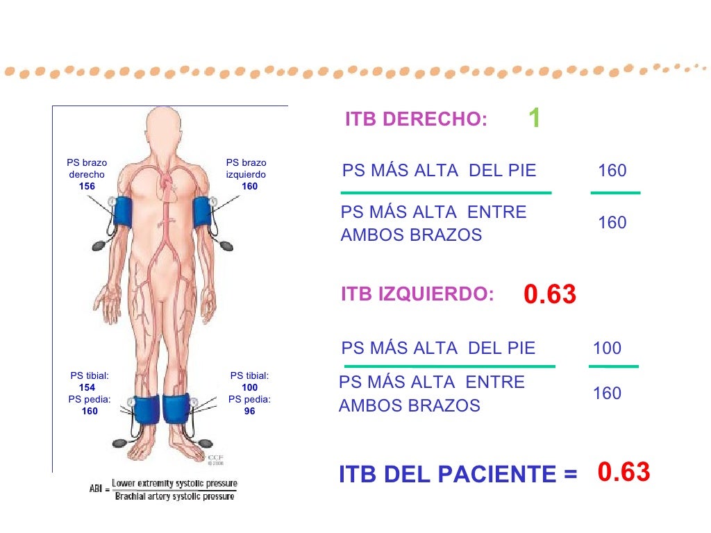 Medición índice Tobillo-Brazo