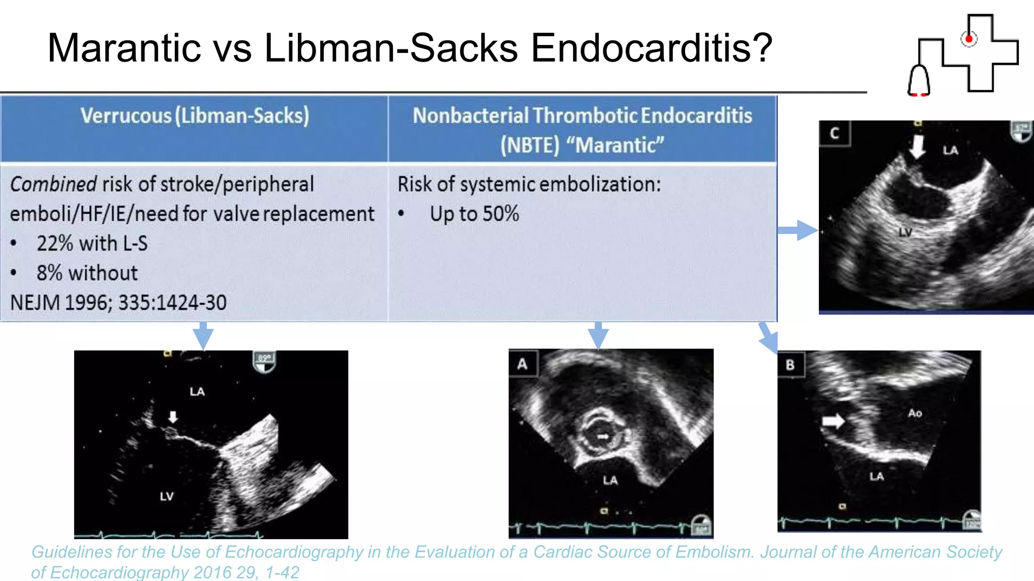 Marantic Endocarditis.pptx