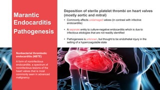 Marantic Endocarditis.pptx