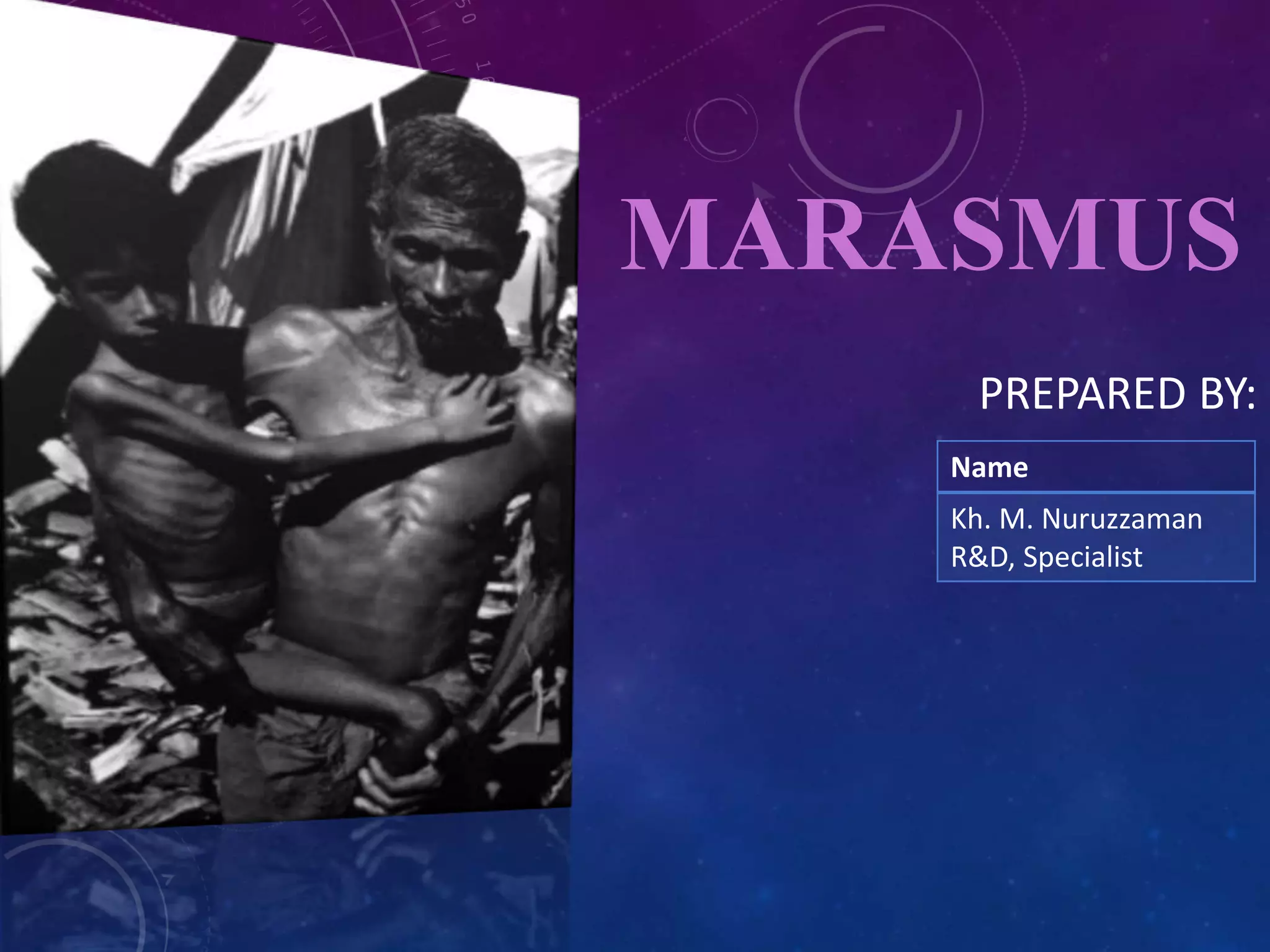 Marasmus a short description | PPT
