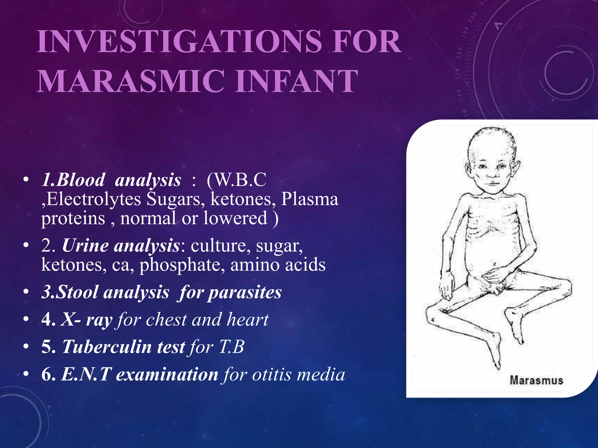 Marasmus a short description | PPT