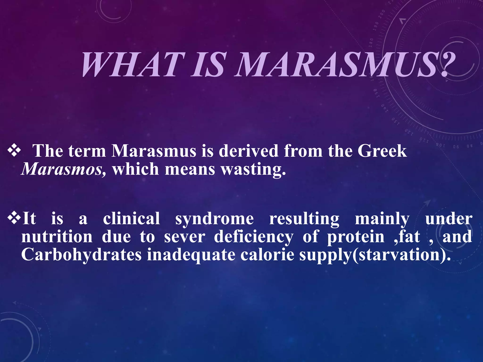 Marasmus a short description | PPT
