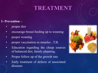 Marasmus a short description | PPT