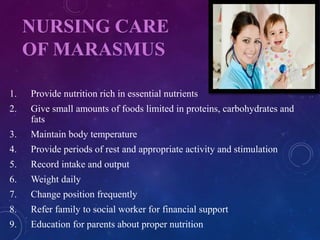 Marasmus a short description | PPT