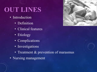 Marasmus a short description | PPT