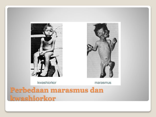 MARASMUS_Marasmus_marasmus_marasmus_marasmuspptx | PPTX