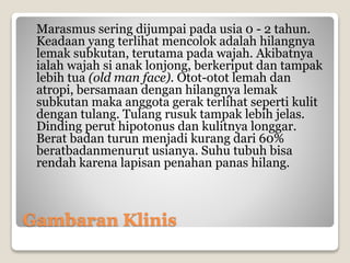 MARASMUS_Marasmus_marasmus_marasmus_marasmuspptx | PPTX