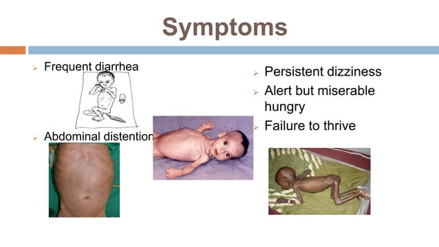 Marasmus biochemistry PowerPoint presentation.pptx | Digestive ...