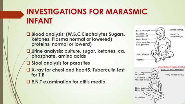 MARASMUS.pdf marsmus pptx difference between marsmus and kwashiorkor presentation about marsmus ...