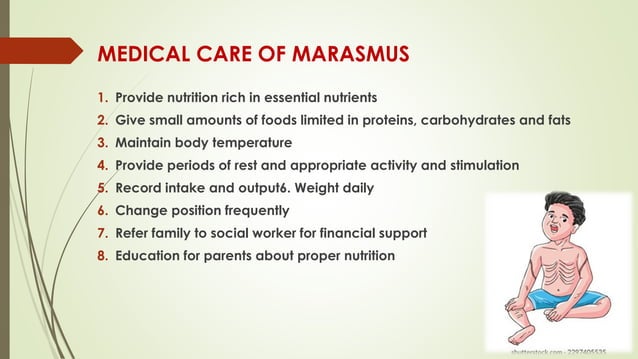 MARASMUS.pdf marsmus pptx difference between marsmus and kwashiorkor presentation about marsmus ...