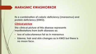 MARASMUS.pdf marsmus pptx difference between marsmus and kwashiorkor presentation about marsmus ...