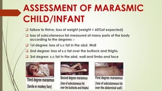 MARASMUS.pdf marsmus pptx difference between marsmus and kwashiorkor presentation about marsmus ...
