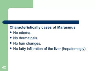 Marasmus. acute protein malnutrition.ppt