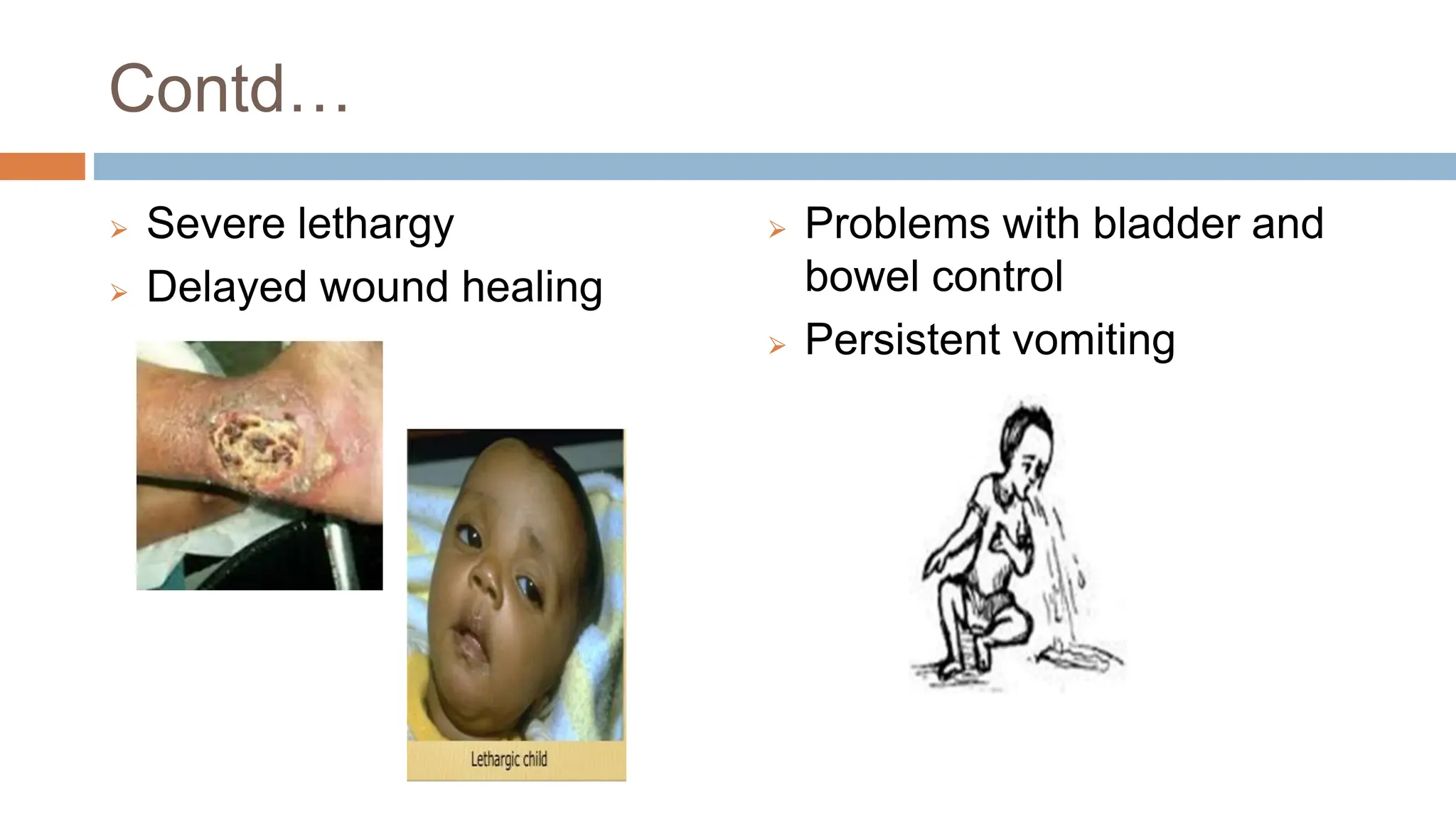 Marasmus final draft.pptx