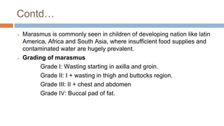 Marasmus final draft.pptx | Digestive Disorders | Diseases and Conditions