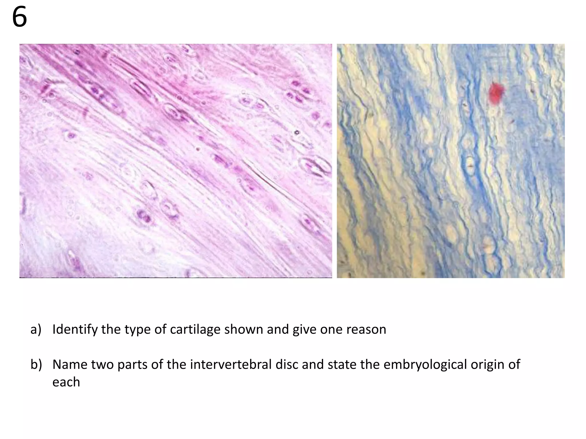 anatomy marathon test | PPTX