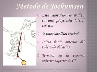 Marcaciones Columna Cervical - 2A - 3.pdf