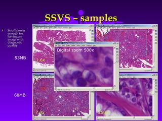 2007- SSVS for hand held microscopes | PPT